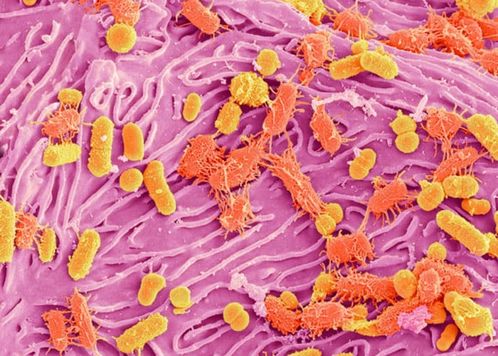 Examples Of Eubacteria